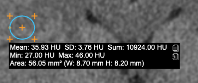 Measure CT Hounsfield Units (HU) and Other Values Using the Ellipse ...